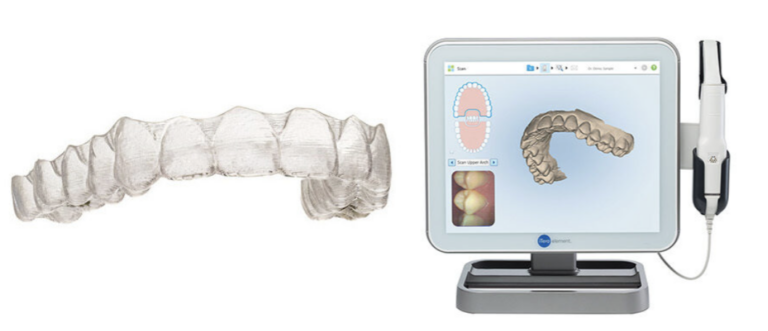 Digital Scanning With The iTero Intraoral Scanner - MiSmile